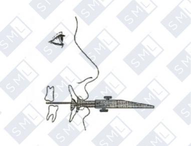 George Gauge, Dental Sleep Product | SML | Southwest