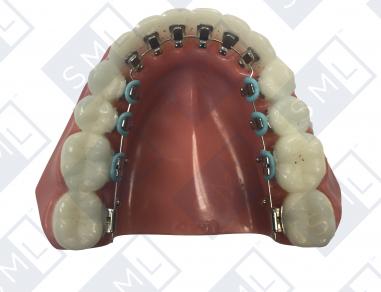 Brackets, Lingual Brackets, Orthodontic Brackets | SML